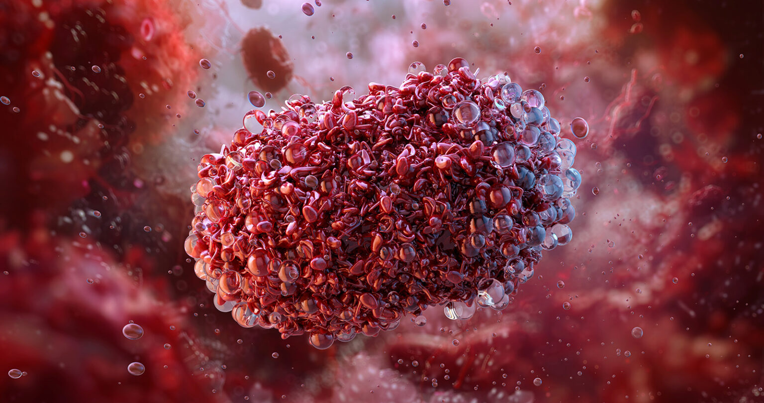 Alerta Global por la MPOX: Viruela Símica, conoce los detalles
