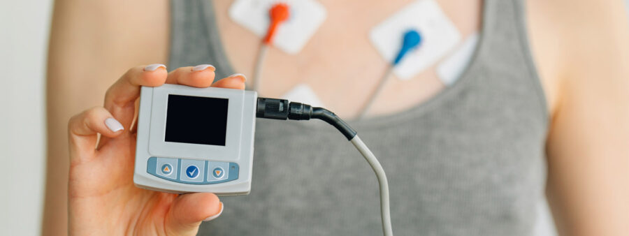 Holter Monitor: The 24-Hour Heart Test That Could Save Your Life